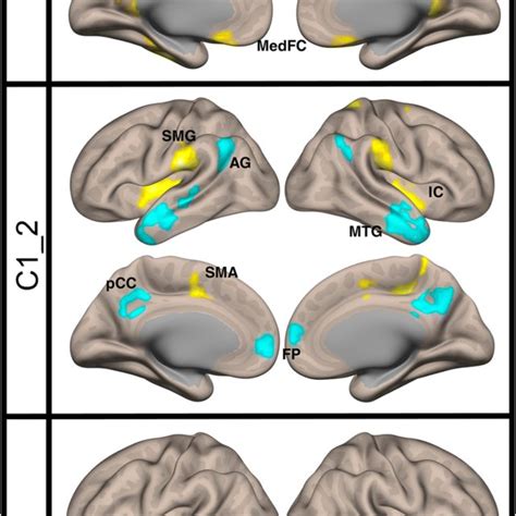 Illustration Of Resting State Multivariate Pattern Analysis Mvpa Download Scientific Diagram