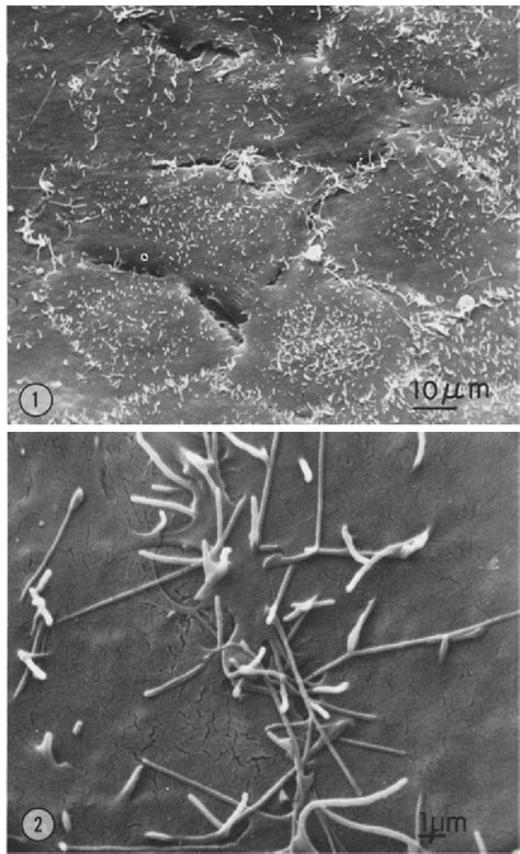 Electron Microscope Real Flu Virus Micropedia