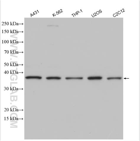 Cdk10 Antibody 30061 1 Ap Proteintech 武汉三鹰生物技术有限公司