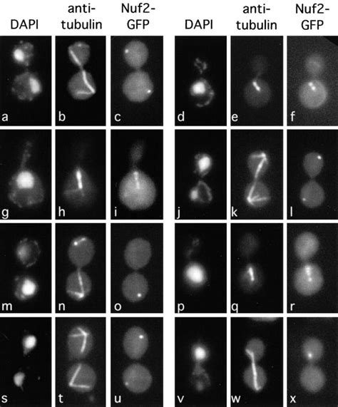 Subcellular Localization Of Gfp Ipl1 And Gfp Sli15 The Dic Download Scientific Diagram