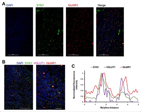 Synapse Analysis Using Double And Triple Staining For Syn1 Glunr1 And Download Scientific