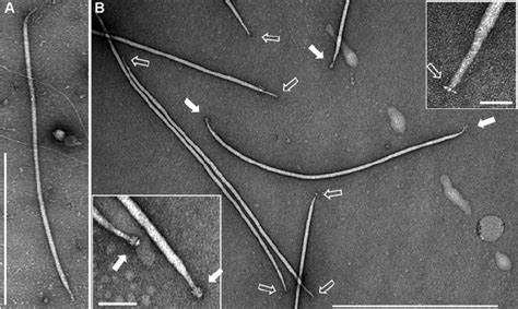 Electron Micrographs Of 2 ␮ M Long Filamentous Viruses From A Hot
