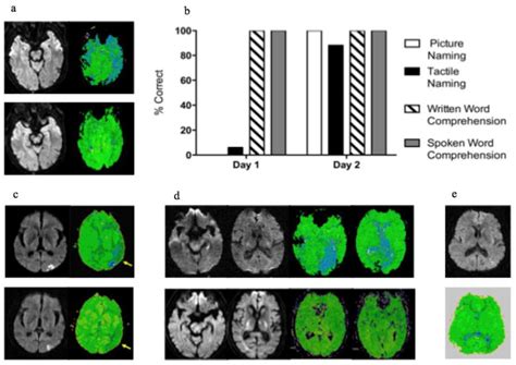 The Roles Of Occipitotemporal Cortex In Reading Spelling And Naming Pmc