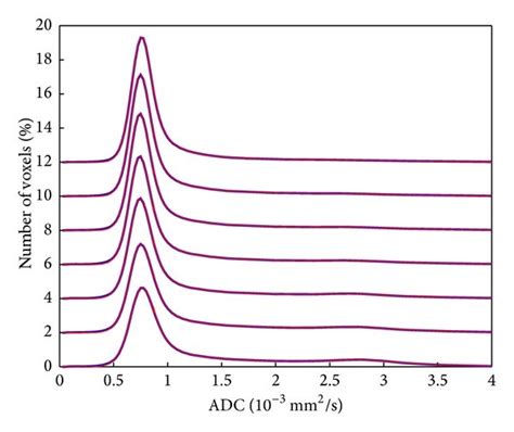 Complete Histograms With Both Parts Of The Fitted Curves With Different Download Scientific