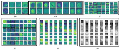 Gastrointestinal Tract Polyp Anomaly Segmentation On Colonoscopy Images Using Graft U Net