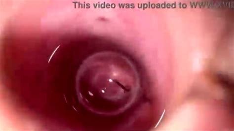 Endoscope Pov Video Thisvid Com