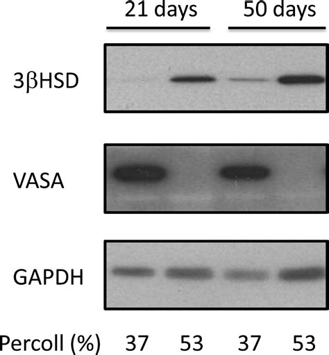 Pdf The Erk12 Pathway Regulates Testosterone Synthesis By
