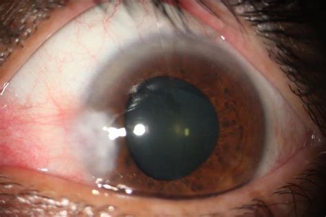 Eyemasking Object Detection Dataset By Eyes