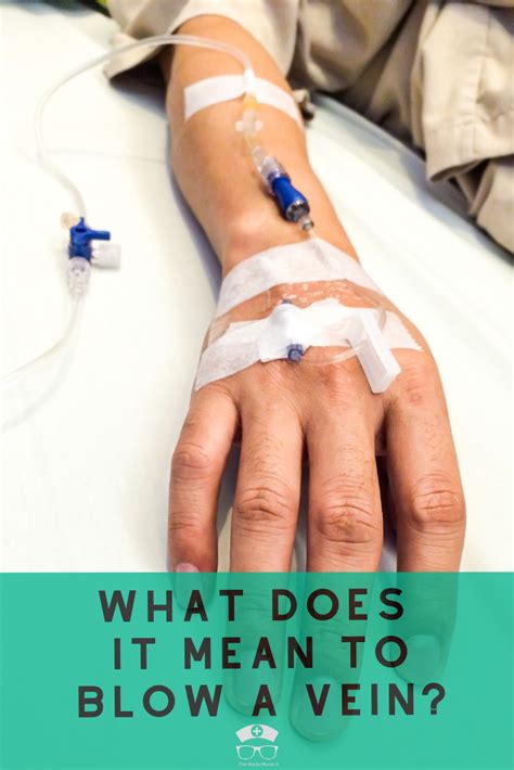 What Does It Mean To Blow A Vein