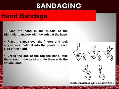 Bandage Ppt
