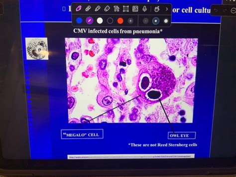 Herpes Viruses Bandb Flashcards Quizlet