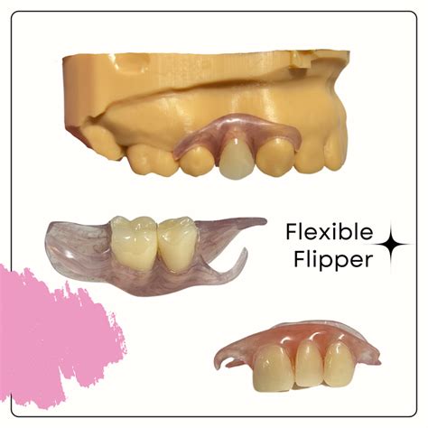 Affordable Partial Dentures Online Order Your Flexible Denture Today At The Best Price