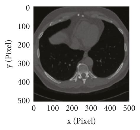 Lung Parenchyma Extraction Process Download Scientific Diagram
