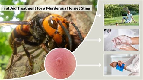 Murderous Hornets Sting Symptoms Reaction And Treatment
