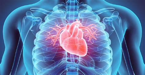 What Is A Perfusion Defect How Can It Be Treated