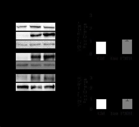 P301L Mutation Leads To Loss Of Nuclear Function A Western Blot Of Download Scientific Diagram