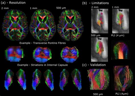 The Digital Anatomist A Whole Brain Diffusion Mri Data Available In Download Scientific