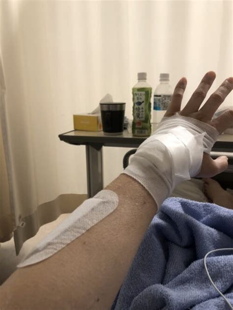 入院23日目腕のストロー抜いた！ 糖尿病で膝下切断かもしれない42歳の闘病日記
