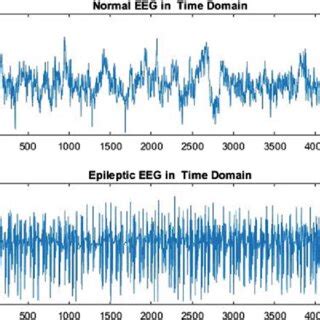 Spectrogram Images In Normal People Download Scientific Diagram