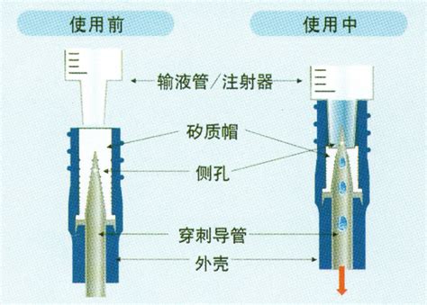 输液管结构 输液器构造及作用图解 输液管的的结构图解 第2页 大山谷图库