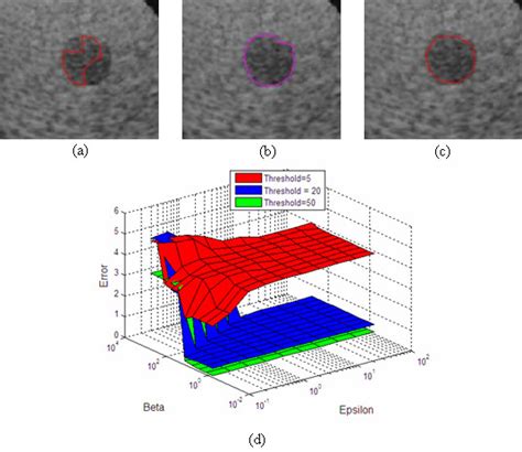 segmentation parameter optimization for the calibrated phantom image