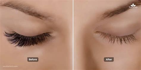 Guide To Safe Eyelash Extension Removal Bid Adieu With Grace