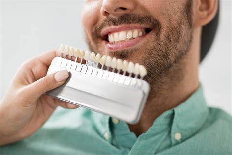 Quick Questions About Veneers Aesthetic Dentistry San Diego Ca