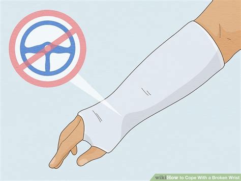 How To Cope With A Broken Wrist With Pictures Wikihow