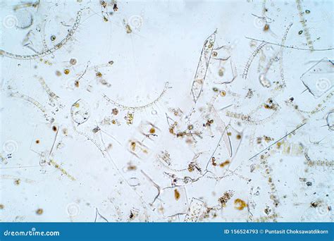Marine Aquatic Plankton Under Microscope View Stock Image Image Of