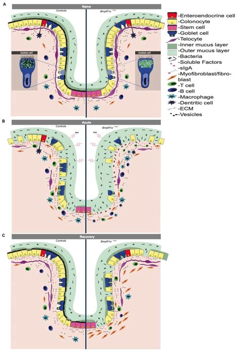 Schematic Representation Of Ibd Pathogenesis Events In Colonic Mucosa Download Scientific