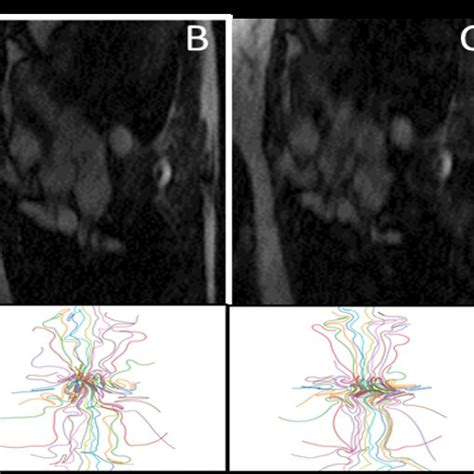 Representative Visual Reconstruction Results Fully Sampled Frame A Download Scientific