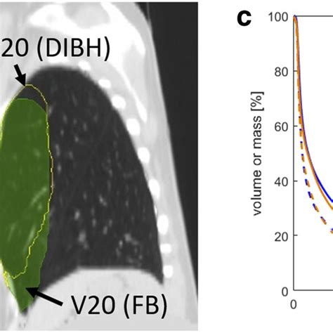 Representation Of The Deformation Vector Field Of A Patient A On A Download Scientific