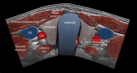 The Role Of Neck Ultrasound In Diagnosing Neck Conditions — Medical