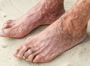 How To Remove Trench Foot How To Dig A Sewer Line Trench Ryuc