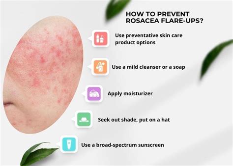 Understanding The Main Causes Of Rosacea Flare Ups