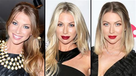 Stassi Schroeders Plastic Surgery Transformation Before And After