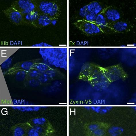 Polarization Of The Actin Cytoskeleton To The Outer Rim Of Migrating Download Scientific