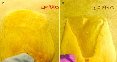 A Lungfish Scale Before Removal Of Squamulae Heavily Mineralized