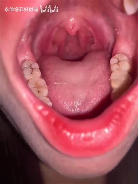 Chinese Girl Shows Her Uvula 12