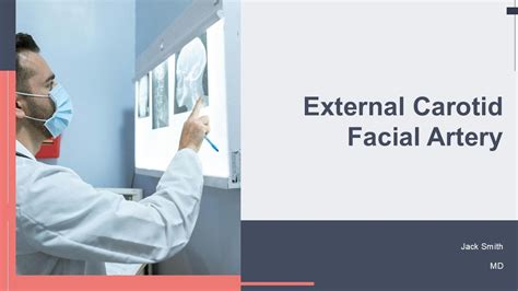 External Carotid Facial Artery Ppt Mockup Acp Ppt Powerpoint