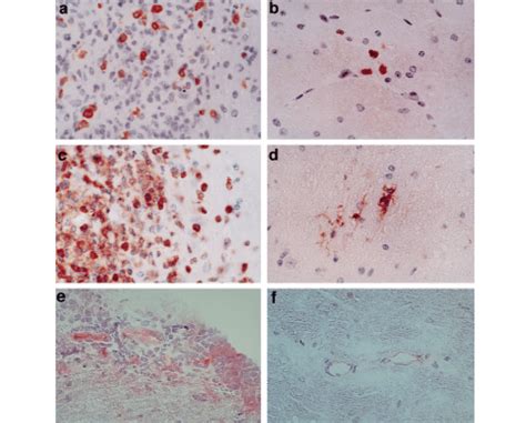 Limited Invasion Of Cd3 T Cells And Monocytes Into The Cns And