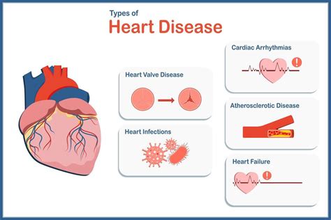 Heart Disease Vector Art Icons And Graphics For Free Download