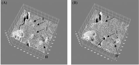 3d Plotting Of The Slice Surface From T1 The Light Gray Spots Pointed Download Scientific