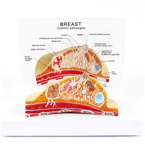 11 Median Section Model Of Human Female Breast Pathology Anatomy Model