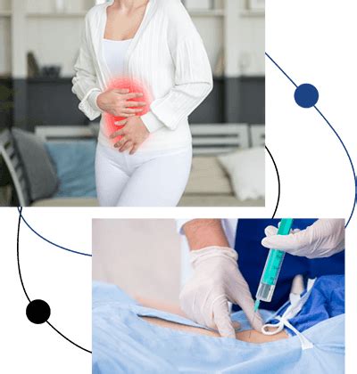 Celiac Plexus Block Pro Spine Pain