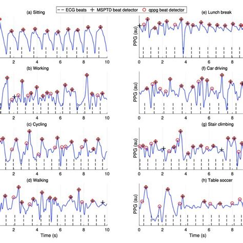 Ppg Beat Detection During Different Activities Ppg Signals Are Shown Download Scientific
