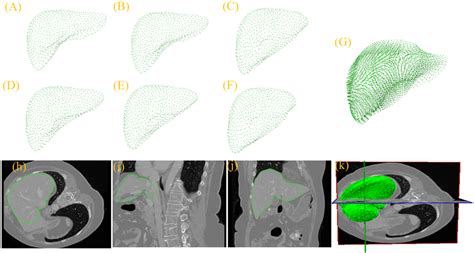Process Of Building The Sparse Statistical Shape Model A F Six Download Scientific Diagram