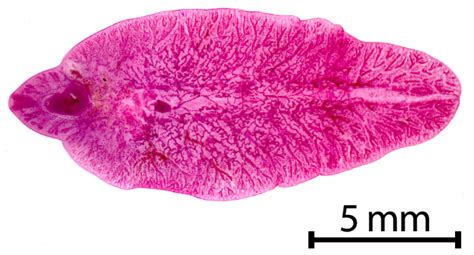What Are Liver Flukes