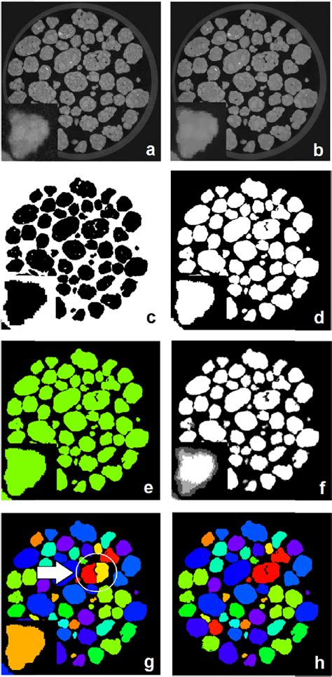 E Different Steps Of The Image Processing Algorithms To Segment