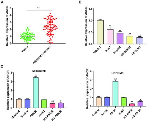 The Expression Of Ancr Was Lowly Expressed In Both Hcc Tissues And Hcc Download Scientific